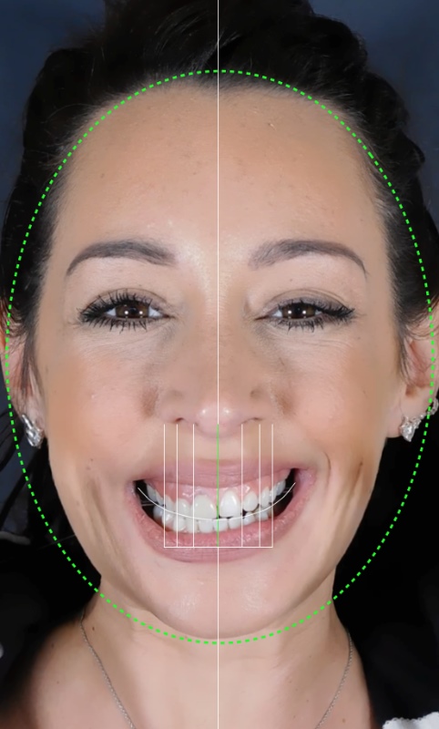 Digital Smile Design Case Studies | Glasgow Smile Clinic